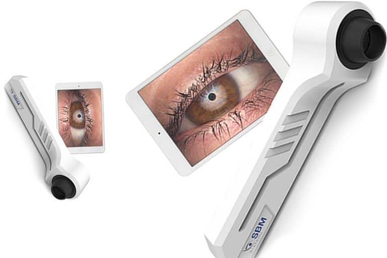 SBM Sistemi Tearscope for Dry Eye - Insight
