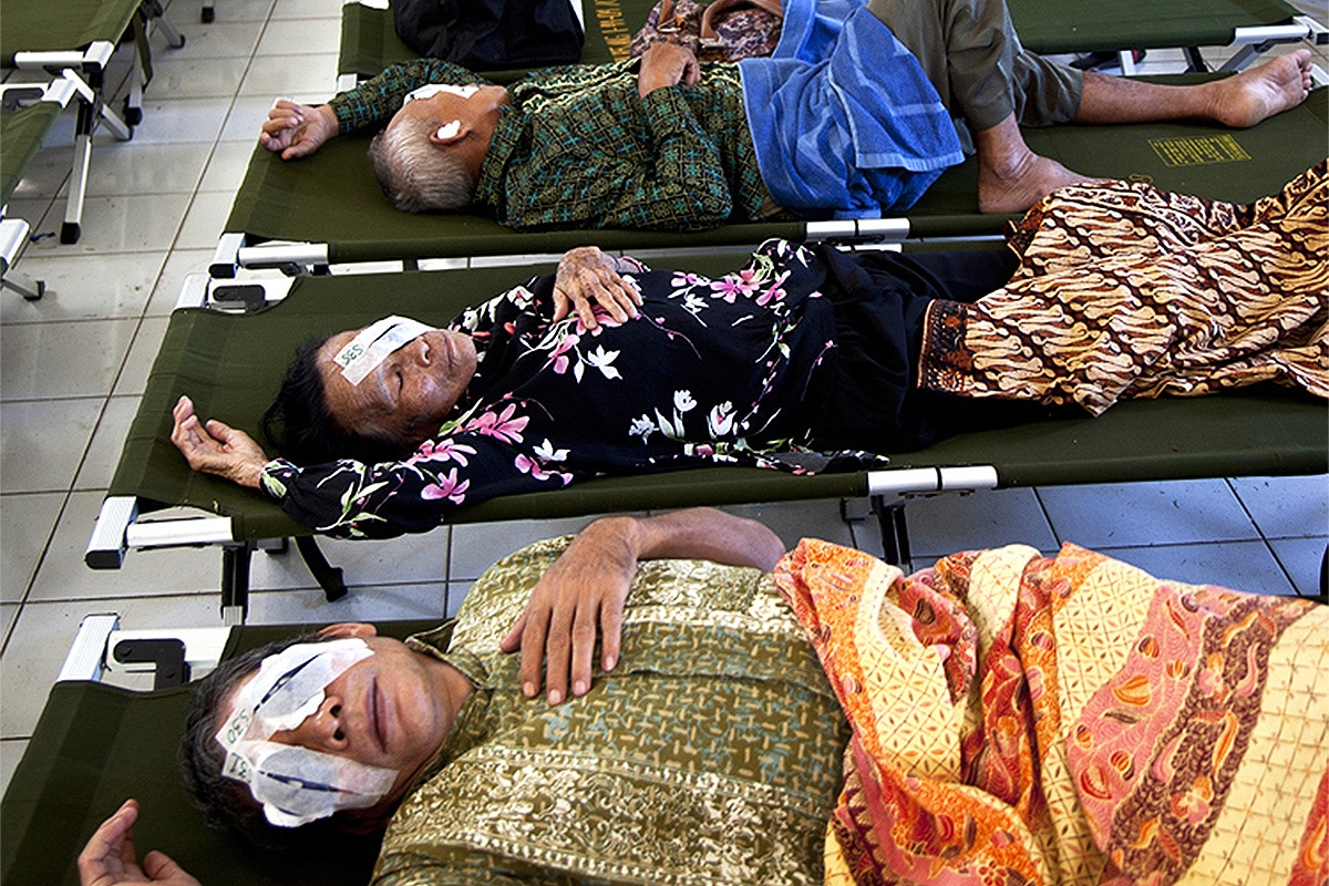 Preventable blindness progress at standstill - Insight