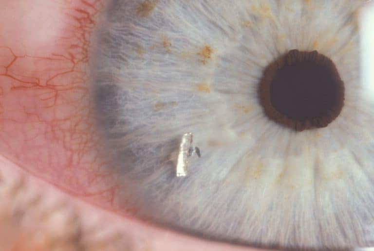 Eyes on the job: injuries and safety eyewear - Insight