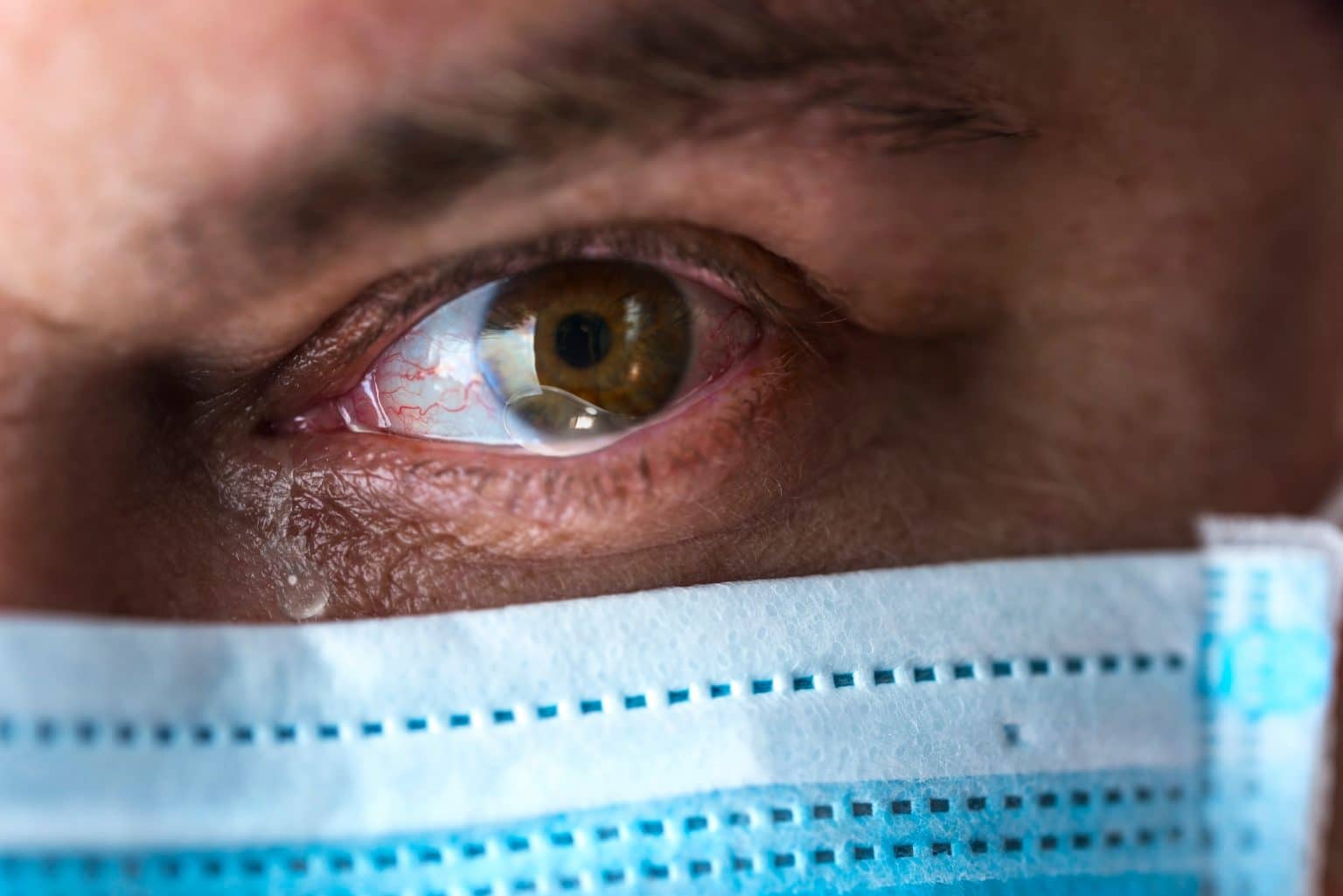 Why face masks cause dry eye, and what ECPs can do to help - Insight