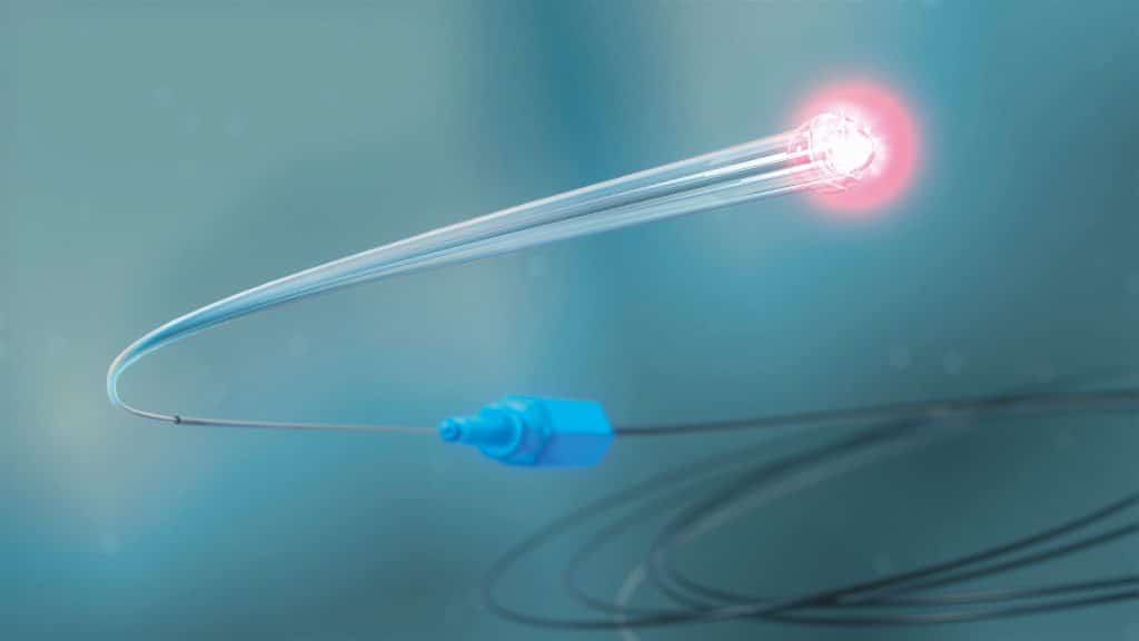 New data shows iTrack efficacy as both standalone and combined MIGS ...
