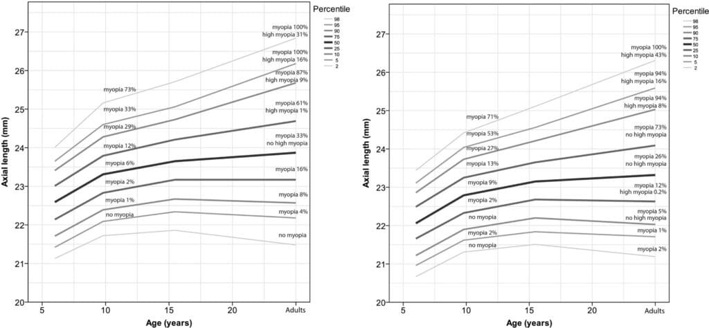 Axial length matters in myopia management - Insight
