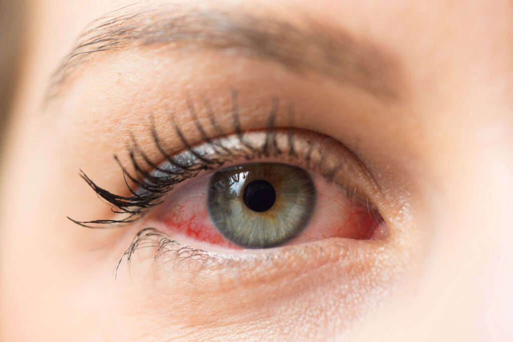 Aussie link in research on device to combat chronic eye pain - Insight