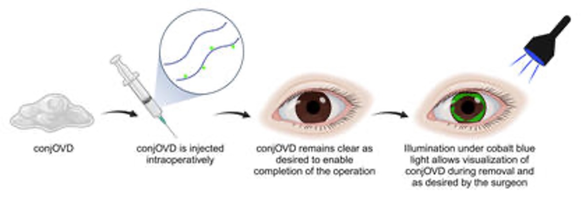 Researchers pioneer colour-changing gel for cataract surgery - Insight
