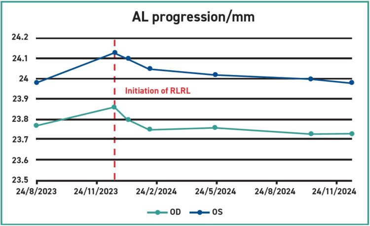 Repeated low-level red-light therapy: a guide for clinicians - Insight