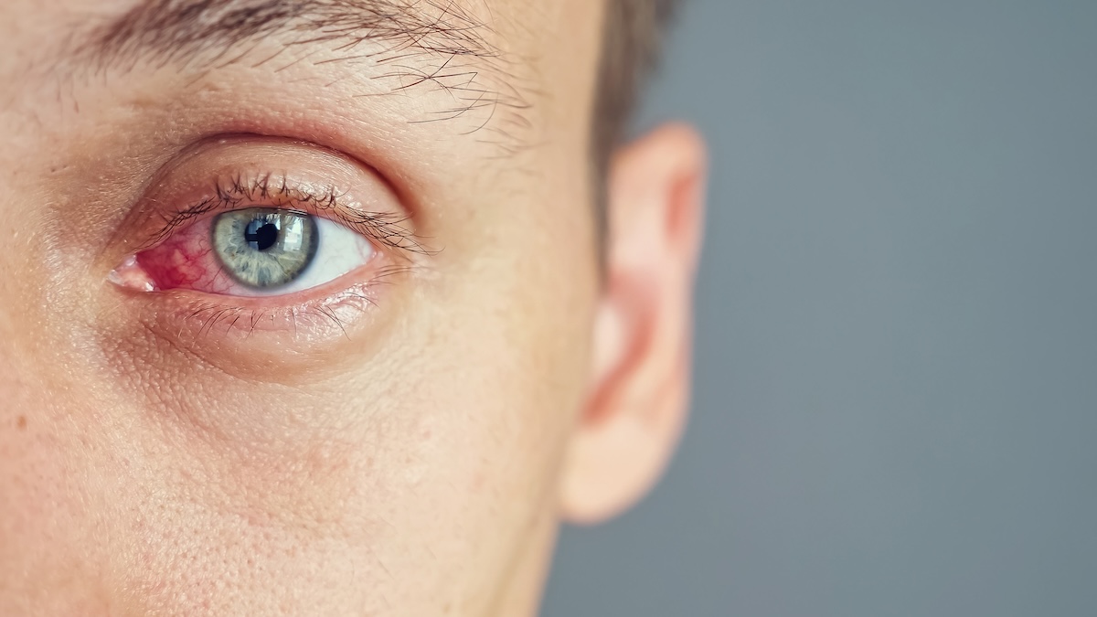 2026 dry eye product showcase - Insight
