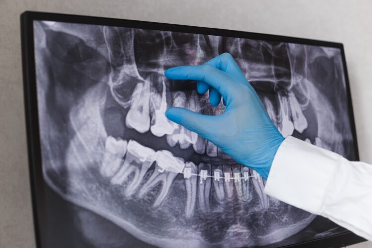 Man's own tooth implanted in eye to restore his vision - Insight