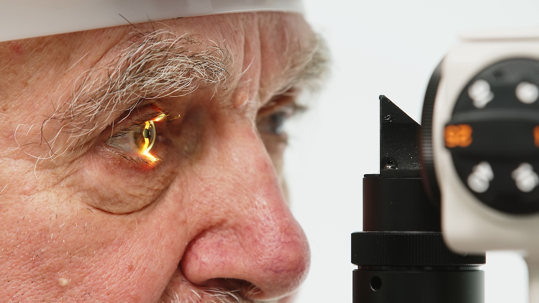 LiGHT study update: SLT outperforms drops in preserving vision over six ...