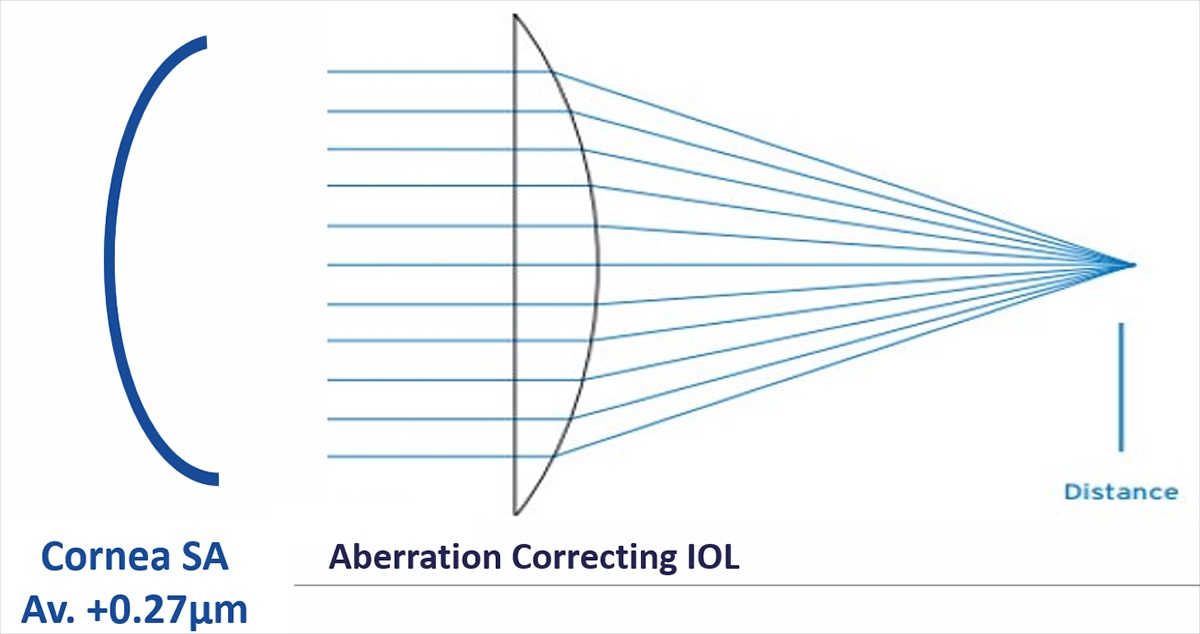 Enhancing the depth of focus in cataract surgery - Insight