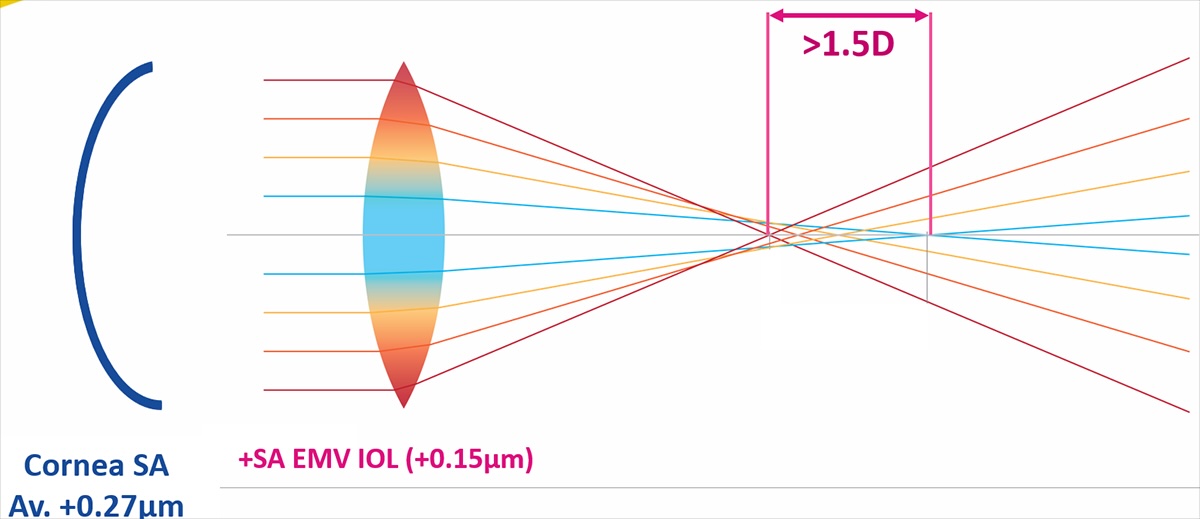 Enhancing the depth of focus in cataract surgery - Insight
