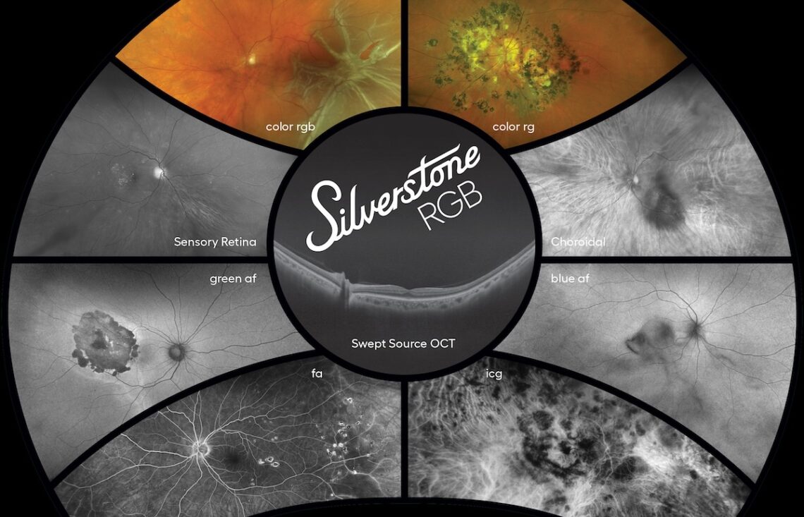 Optos unveils 'most advanced' Silverstone RGB retinal imager - Insight