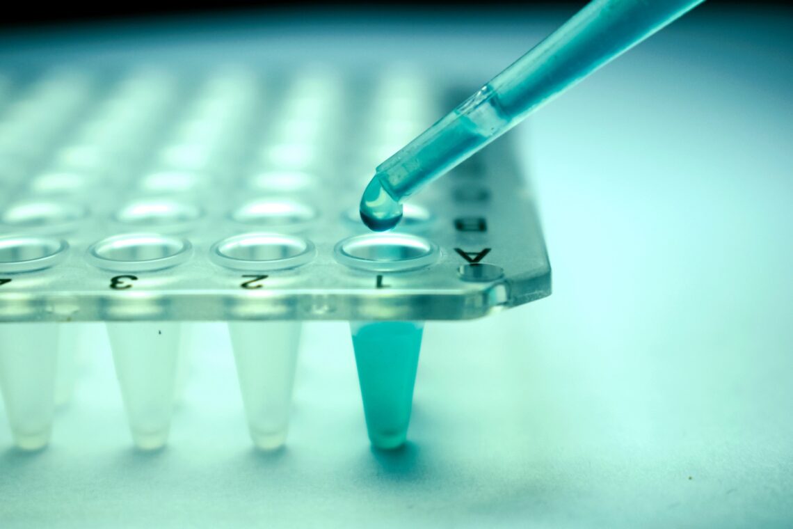 Stem-cell retinal implant shows promise in dry AMD - Insight