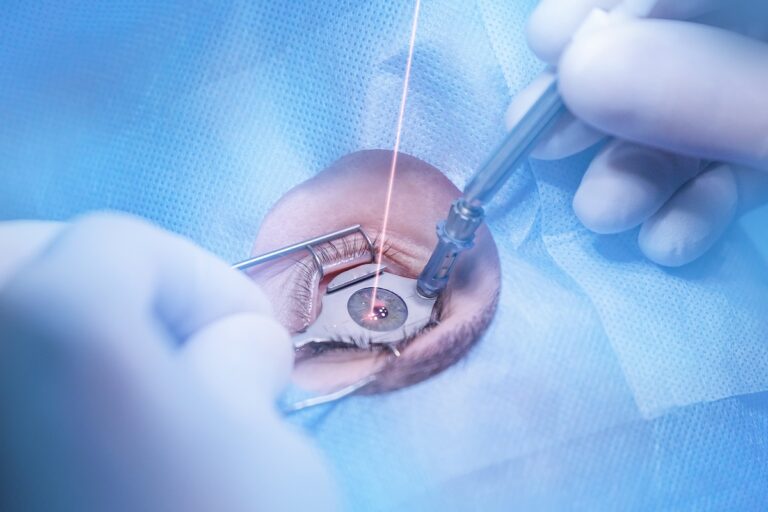 Research: EDOF IOL achieves favourable results in complex post-LASIK ...