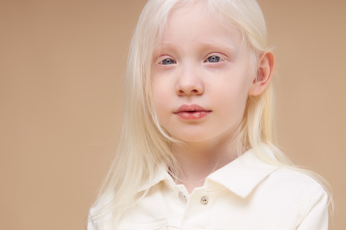 Genome-wide testing improves diagnosis of inherited eye conditions ...